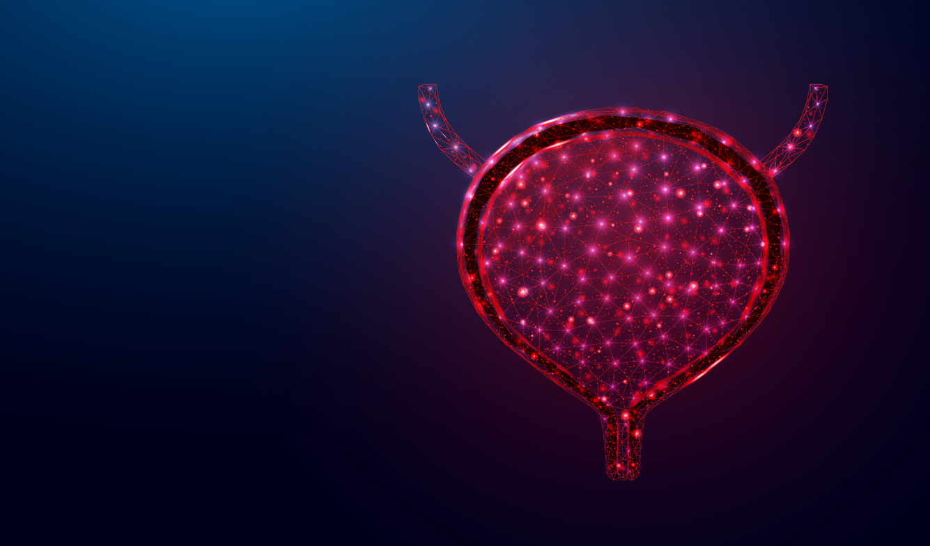 Καρκίνος Ουροδόχου Κύστης | Συμπτώματα, εξετάσεις και θεραπεία